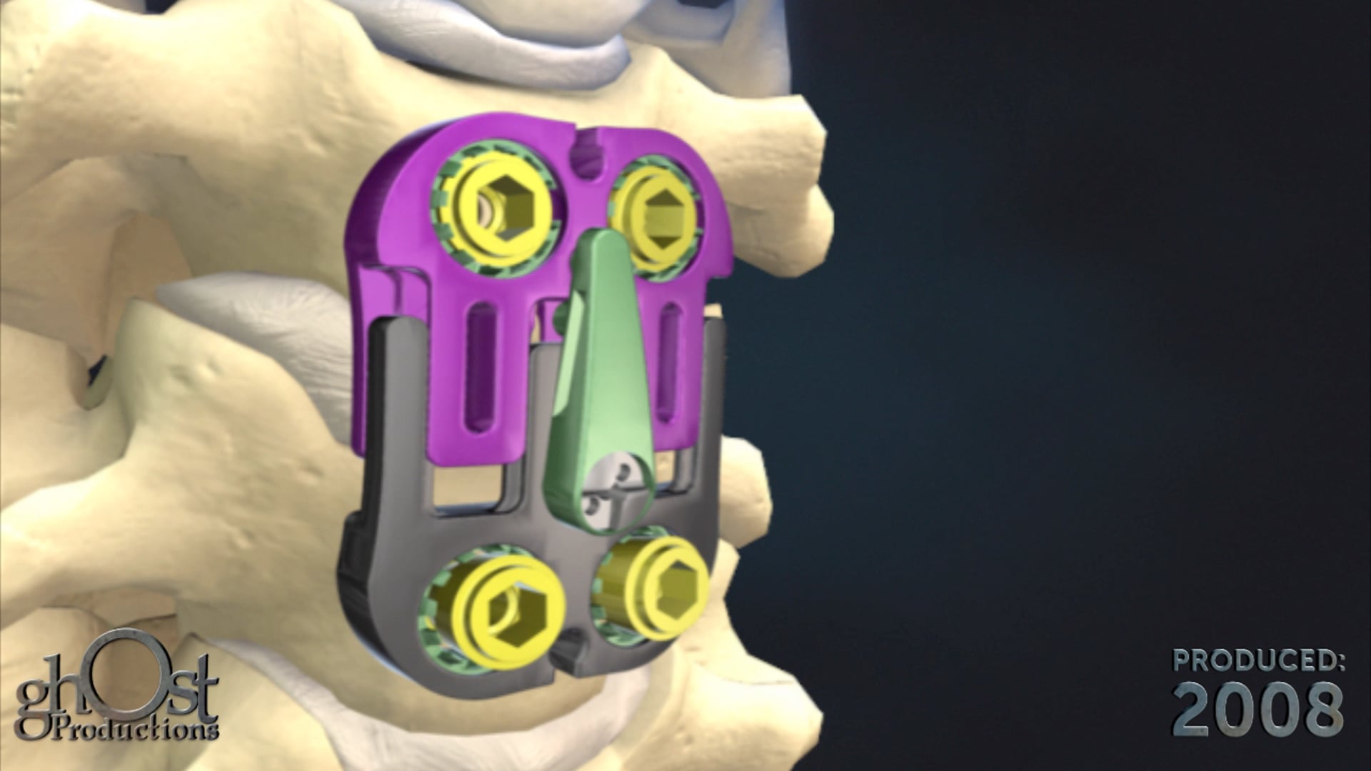 Abbott Pathfinder | Video