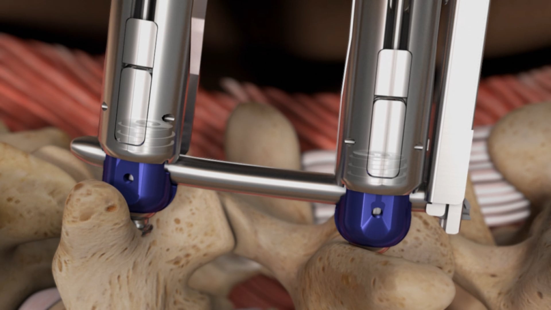 Spineology | Ghost Medical Client