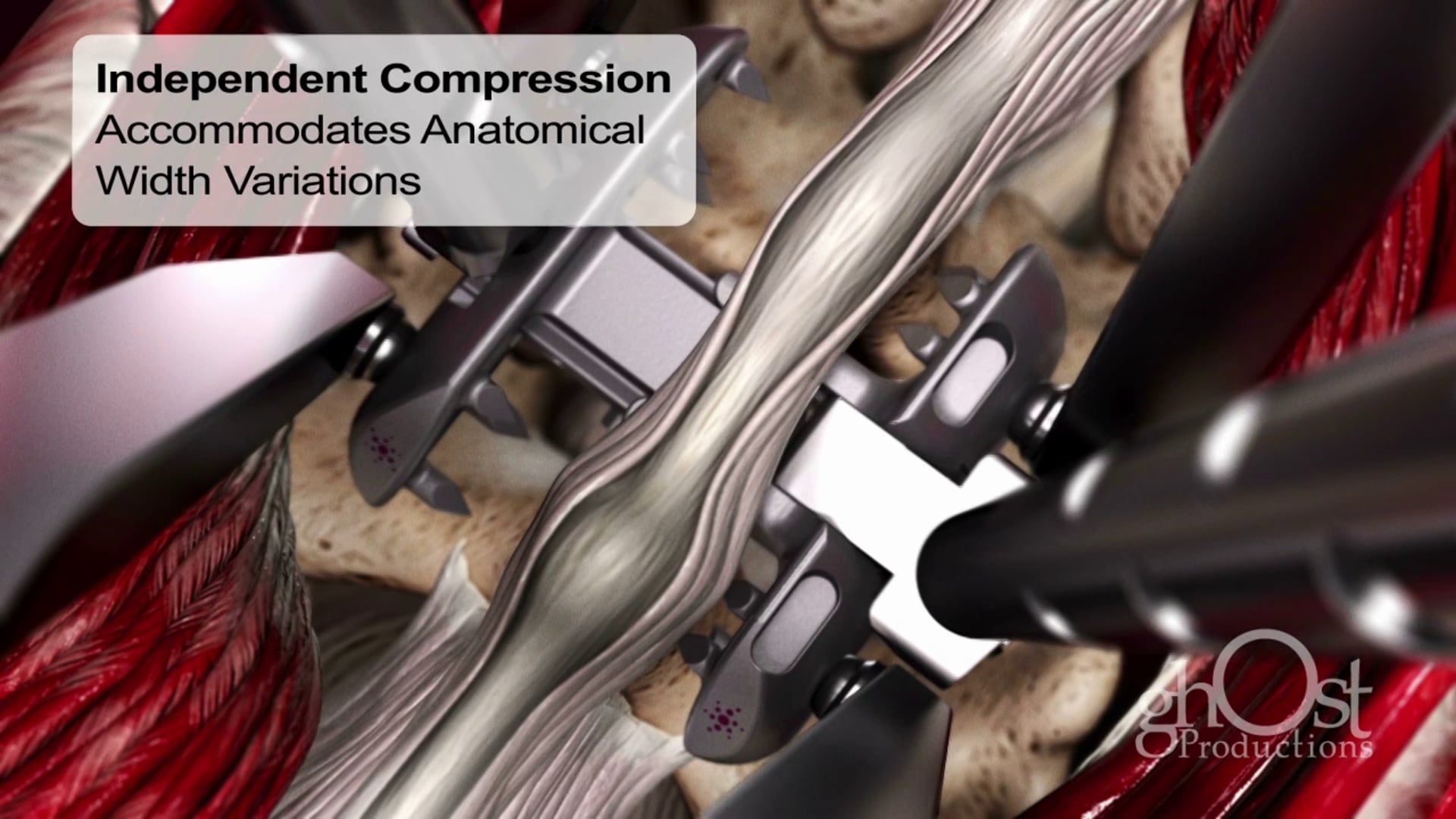 Ghost Productions - Spineology - Via - HD | Video