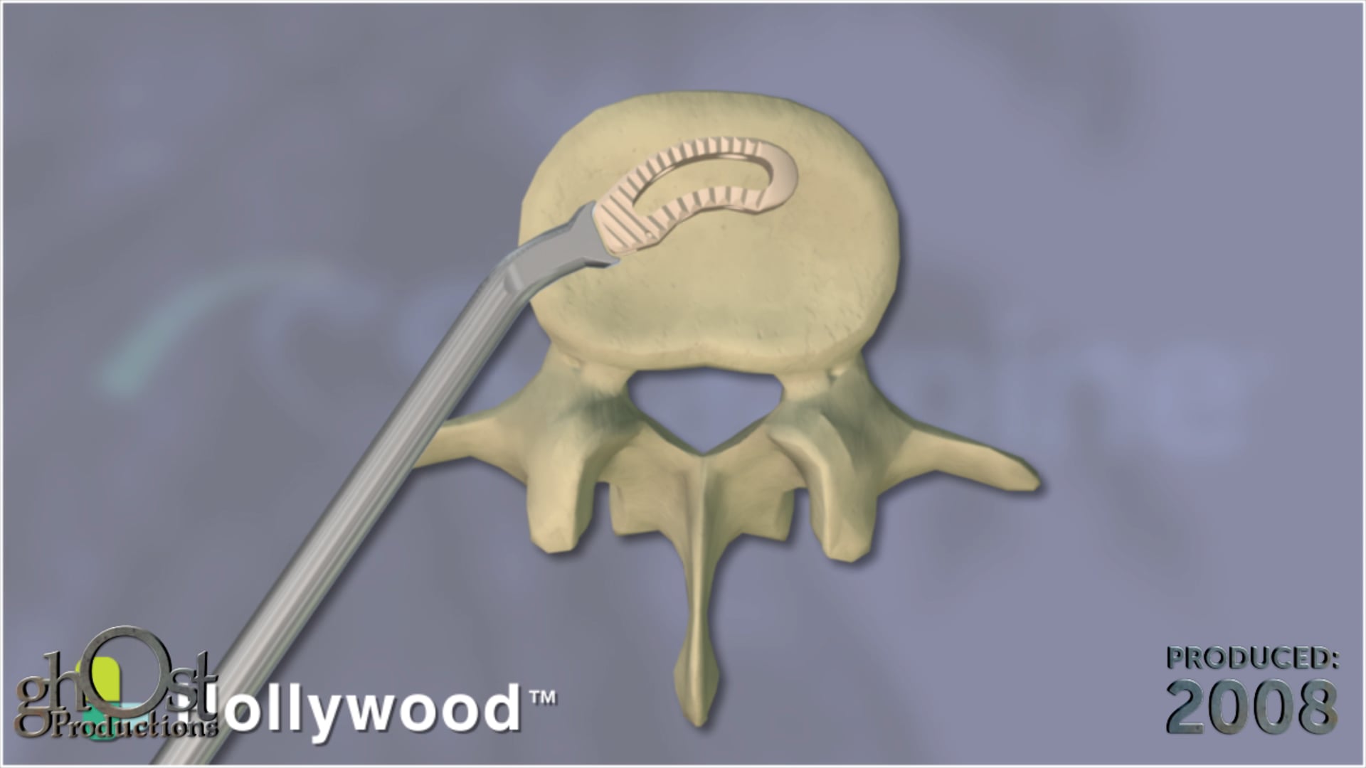 SeaSpine | Ghost Medical Client