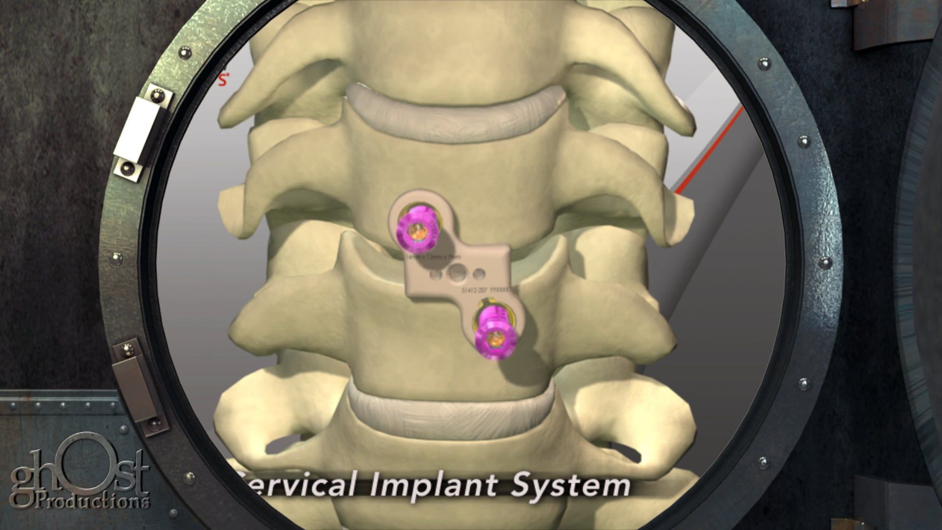Spinal Elements | Ghost Medical Client