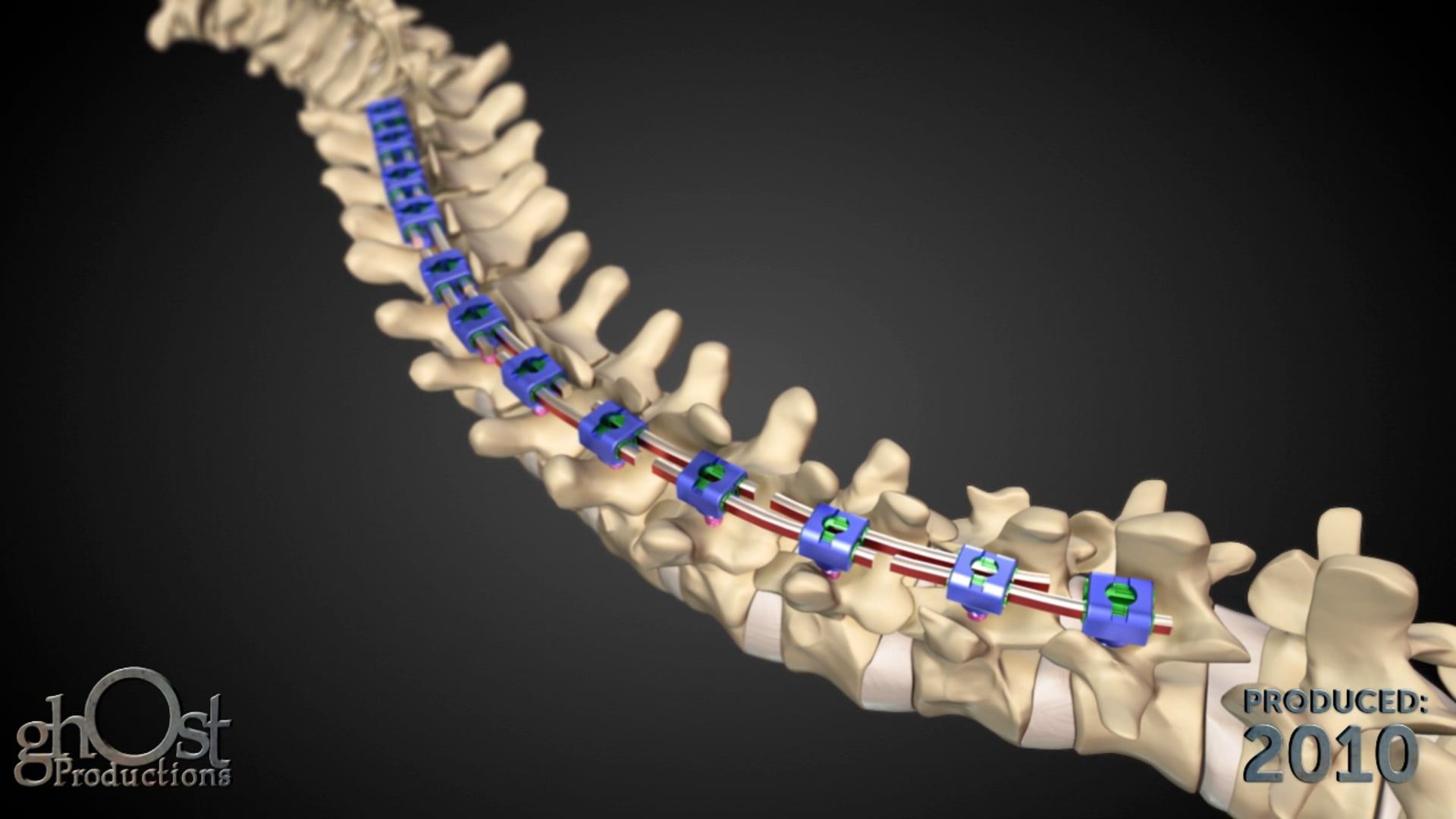 Intelligent Implant Systems | Ghost Medical Client