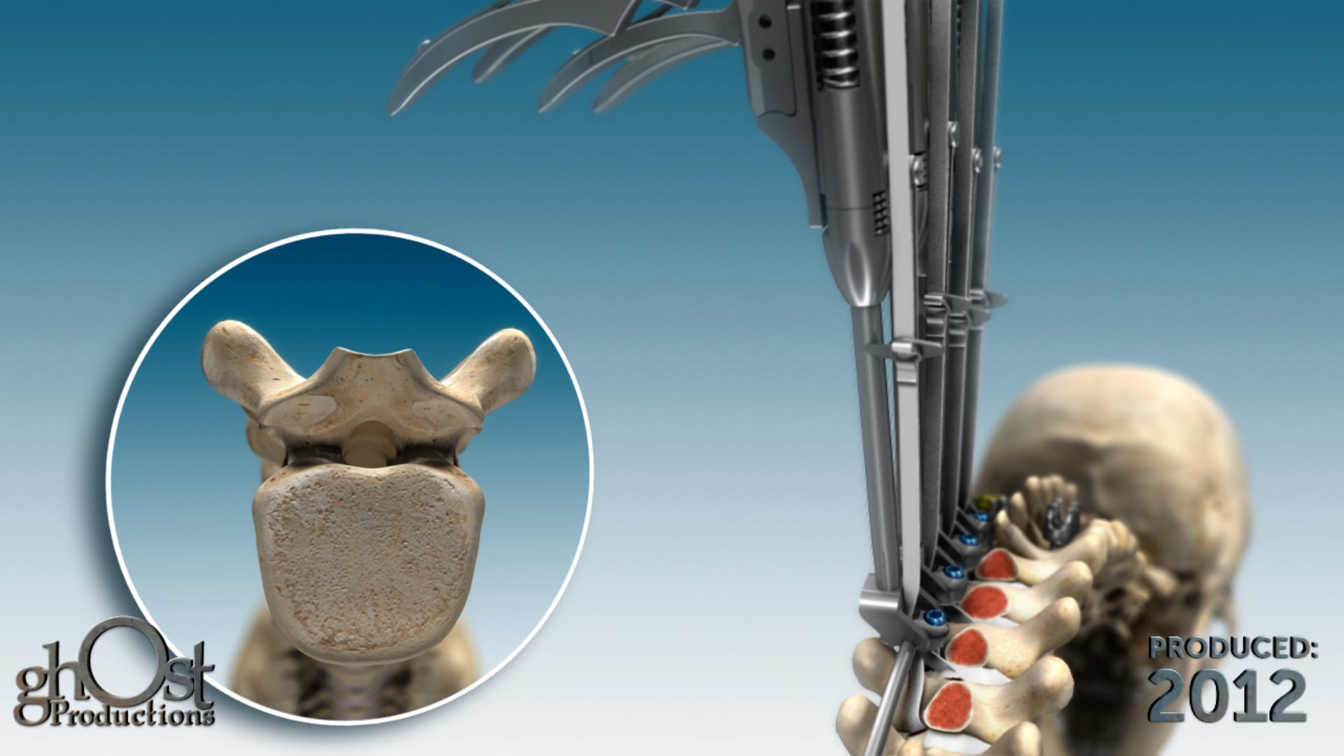 Zimmer Universal Clamp | Video