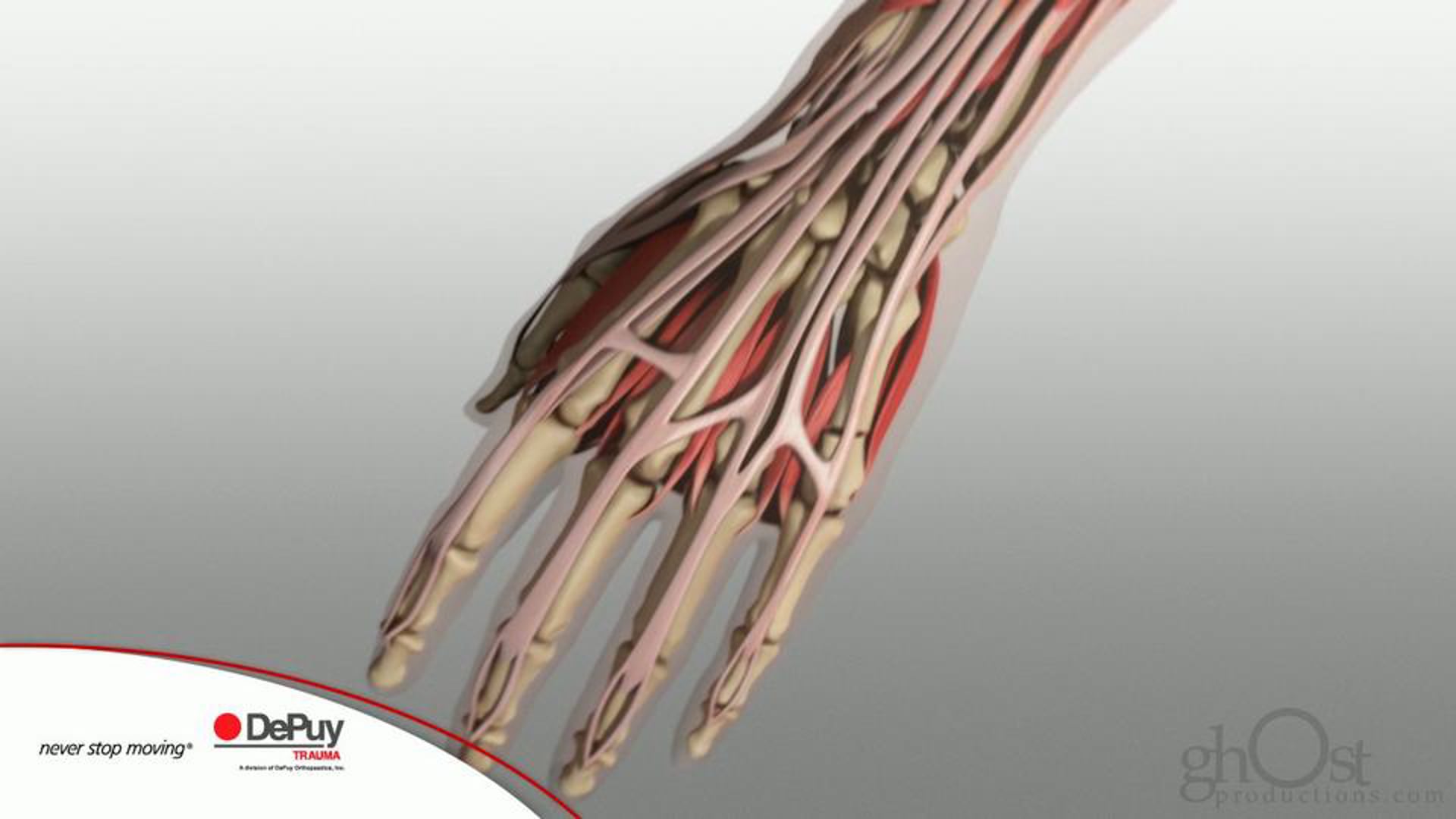 Depuy Trauma - Small Bone Fixation System Surgical Technique | Video