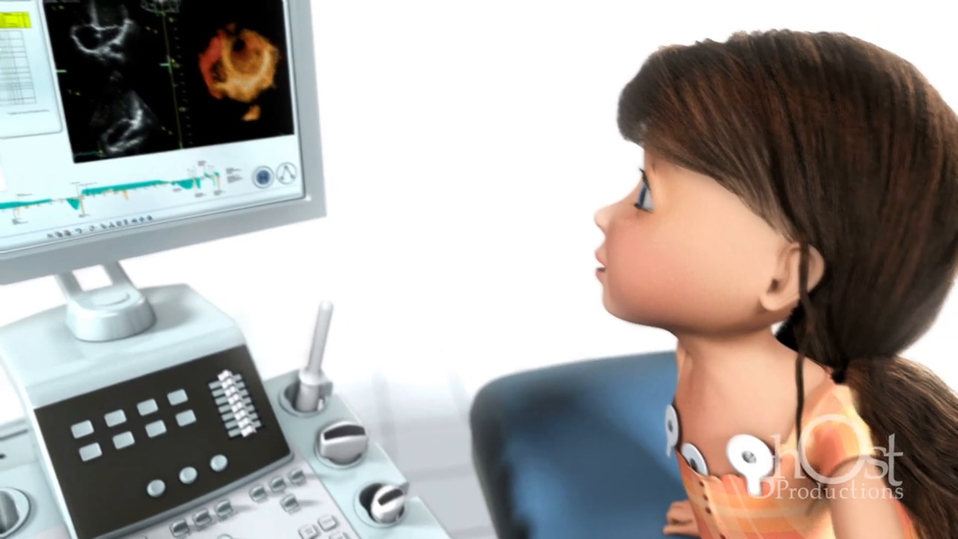 Cardiovascular Animation - Simulia - Inspiring Hope | Video