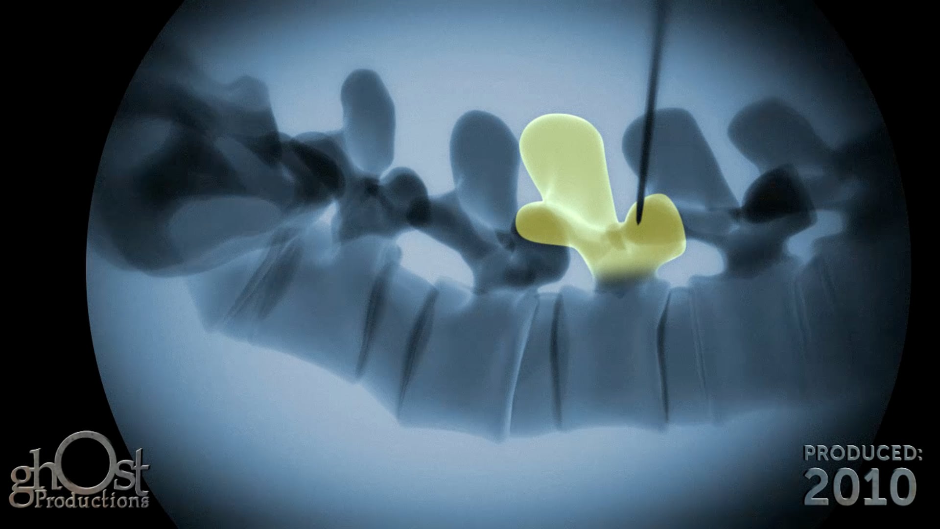 Zimmer Guide for A/P Lateral Imaging | Video