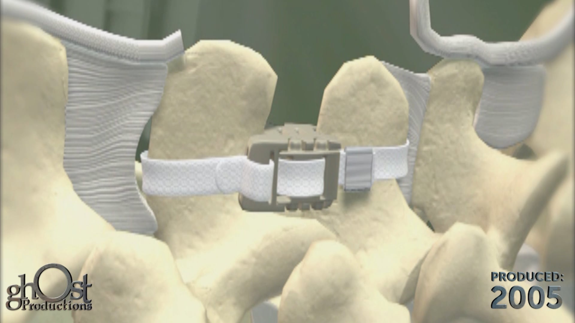 Abbott Wallis | Video