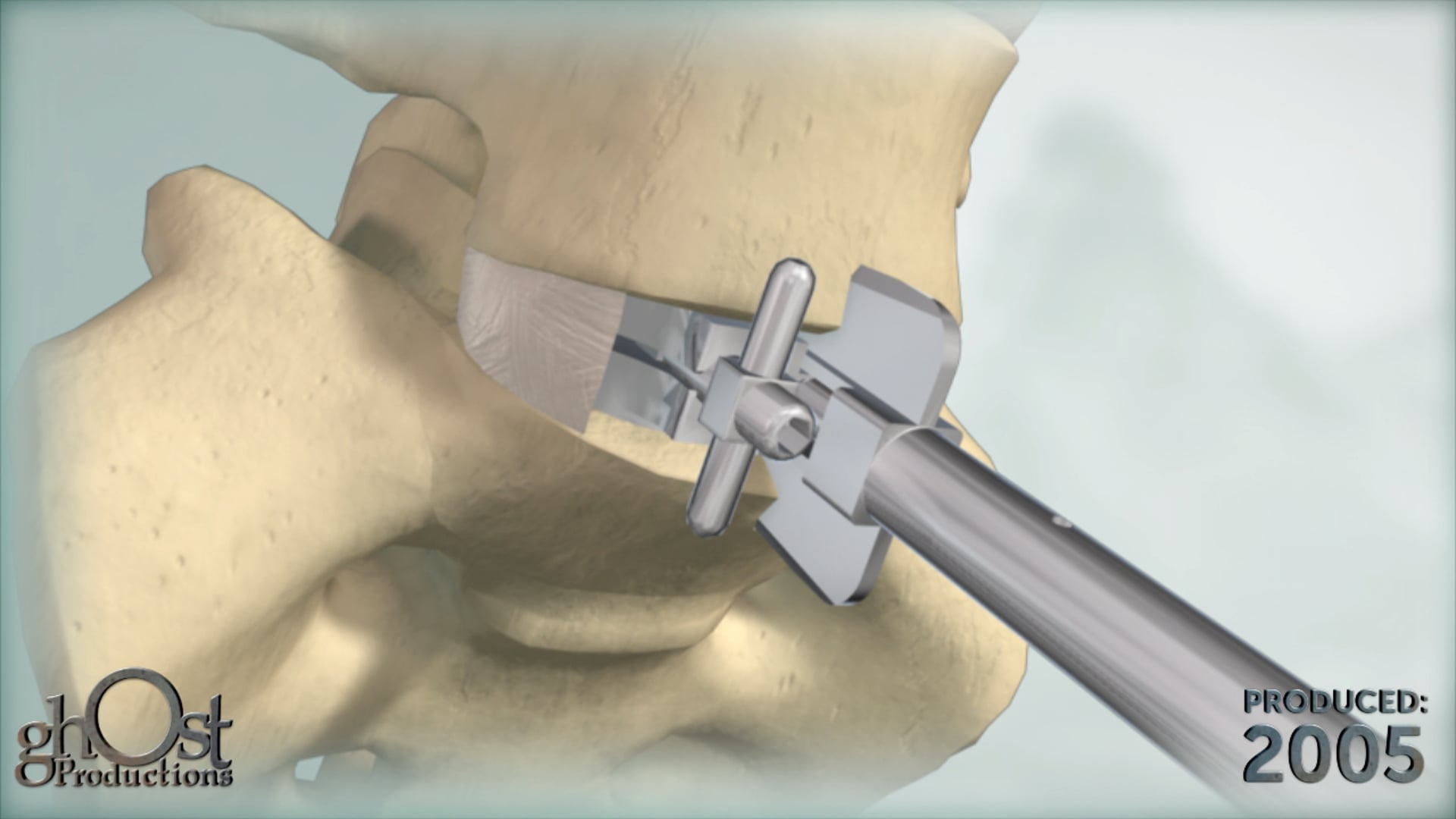 Synthes | Ghost Medical Client