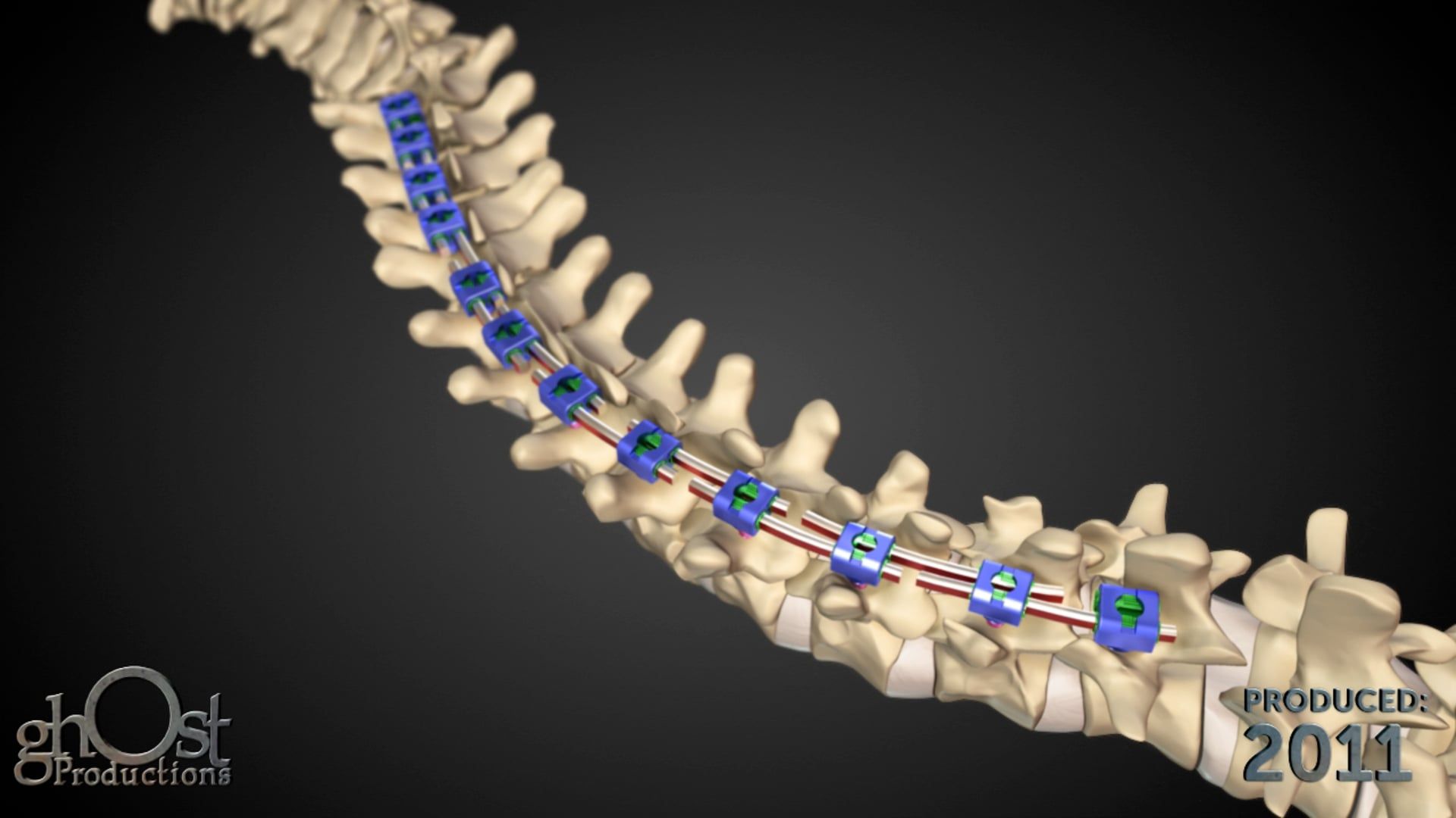 Intelligent Implant Systems | Ghost Medical Client