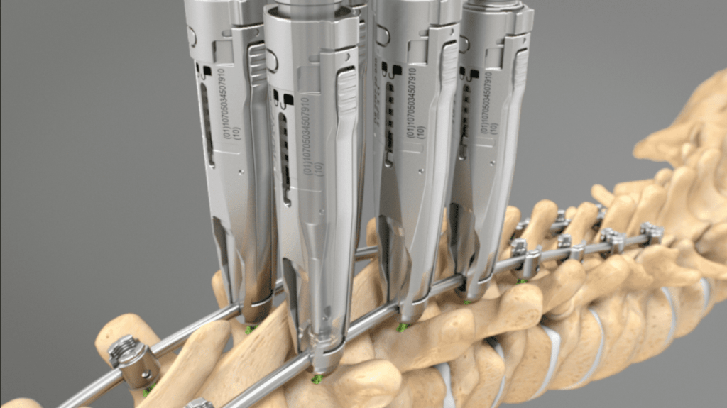 Depuy Viper | Ghost Medical Images