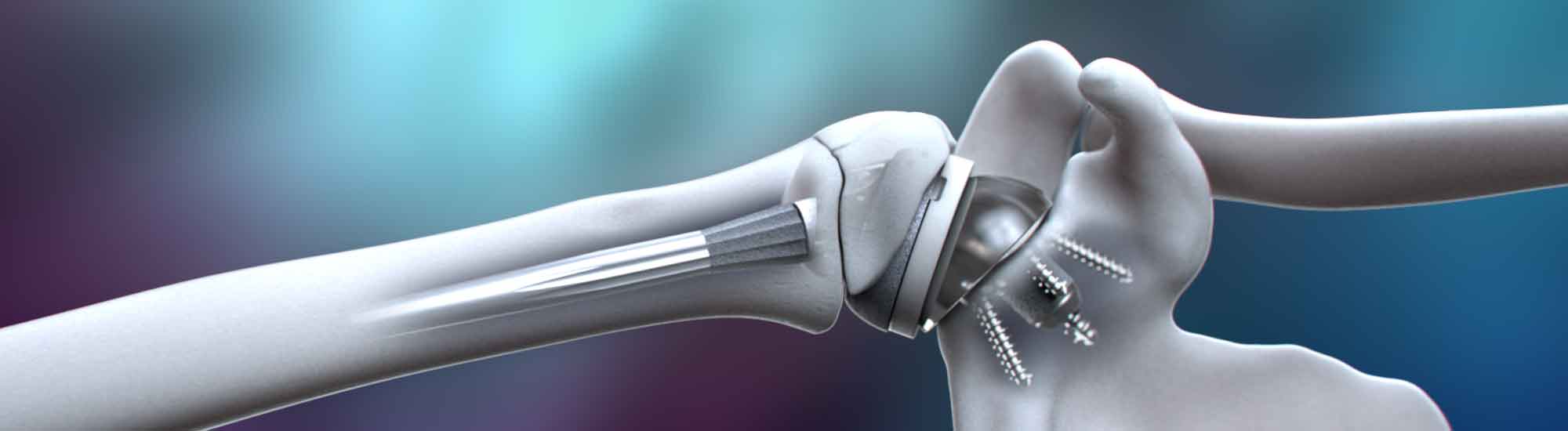 Integra Life Sciences | Ghost Medical Client