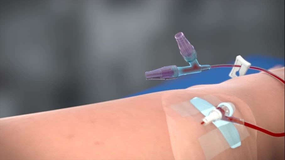 Smiths Medical | Ghost Medical Client