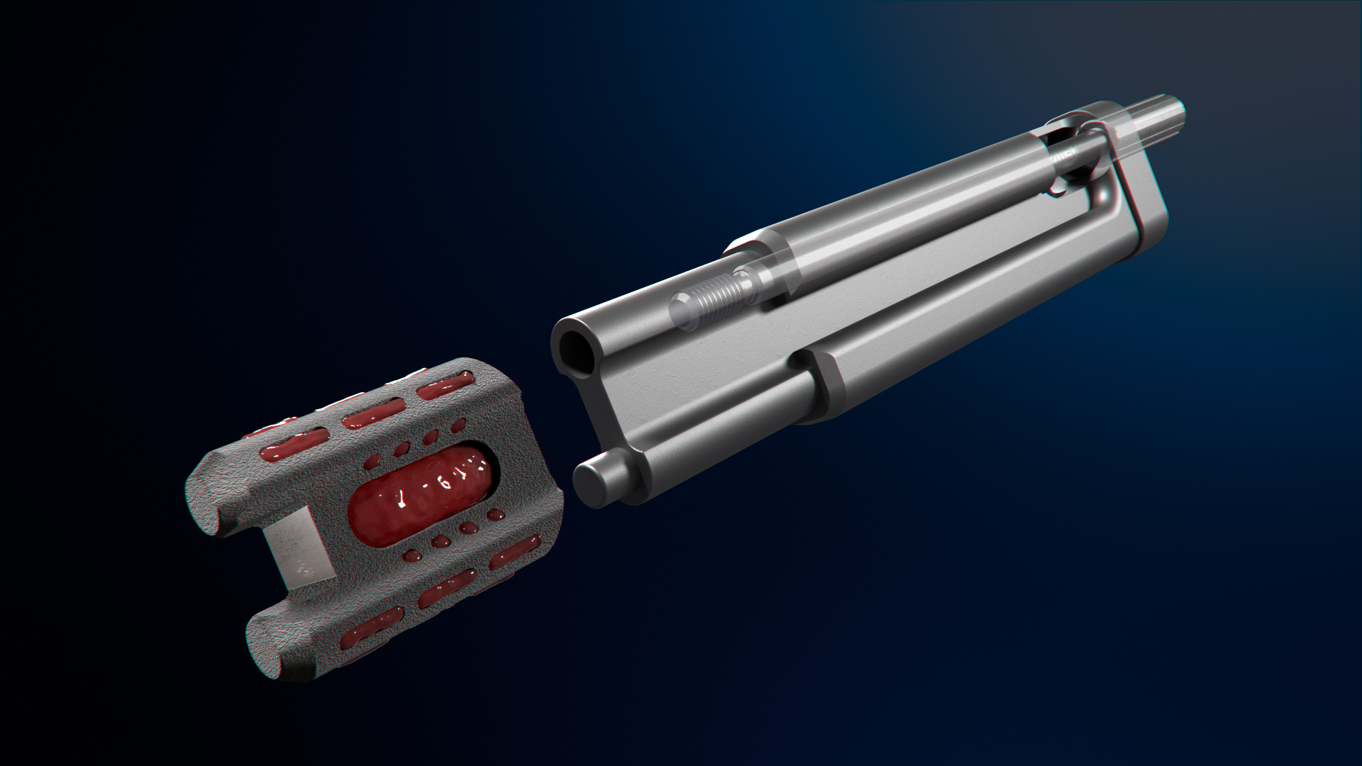 Tenon Medical's Catamaran SI Joint Fusion System | Image