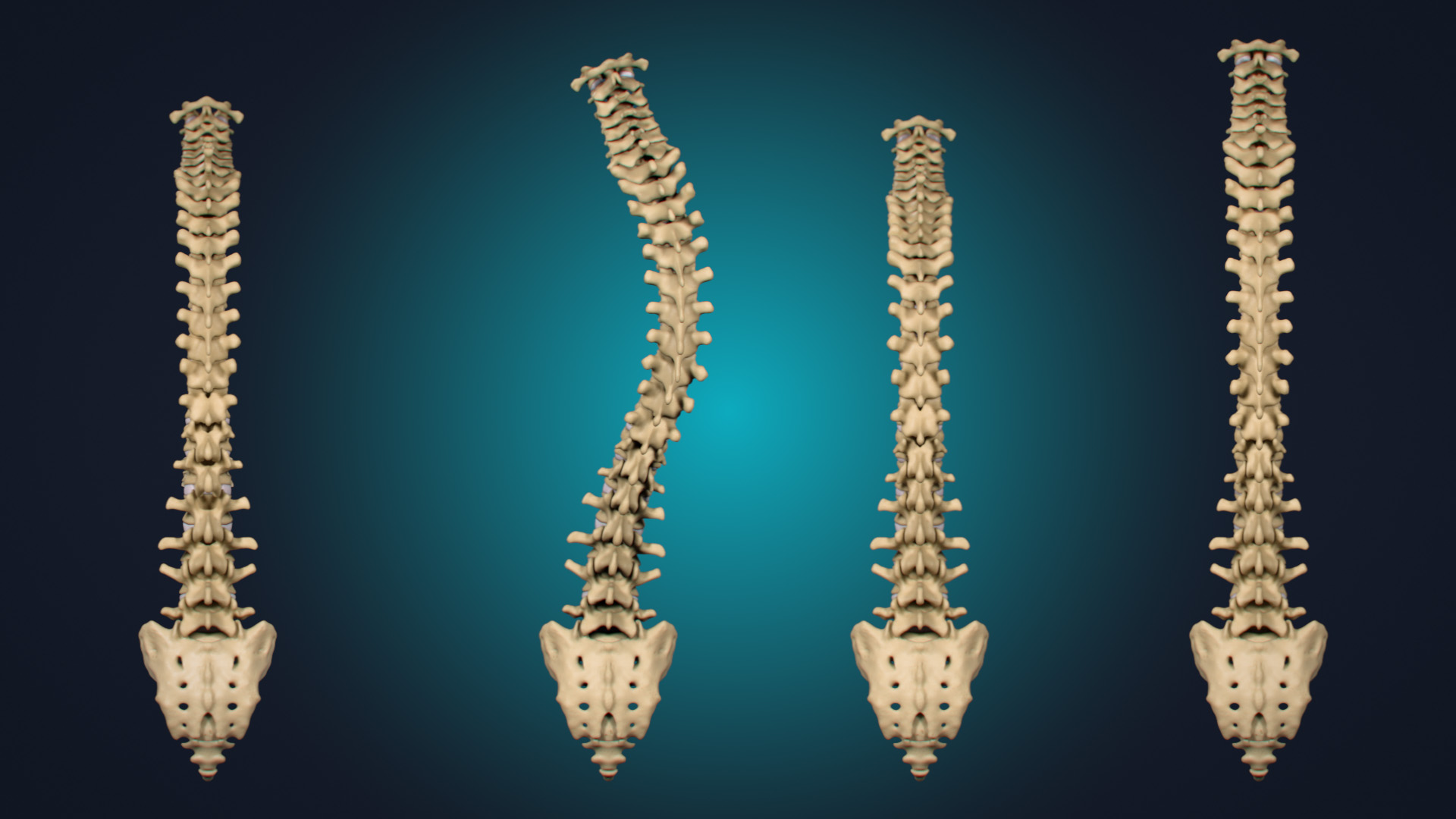 Spinal Deformities & Injuries | Image