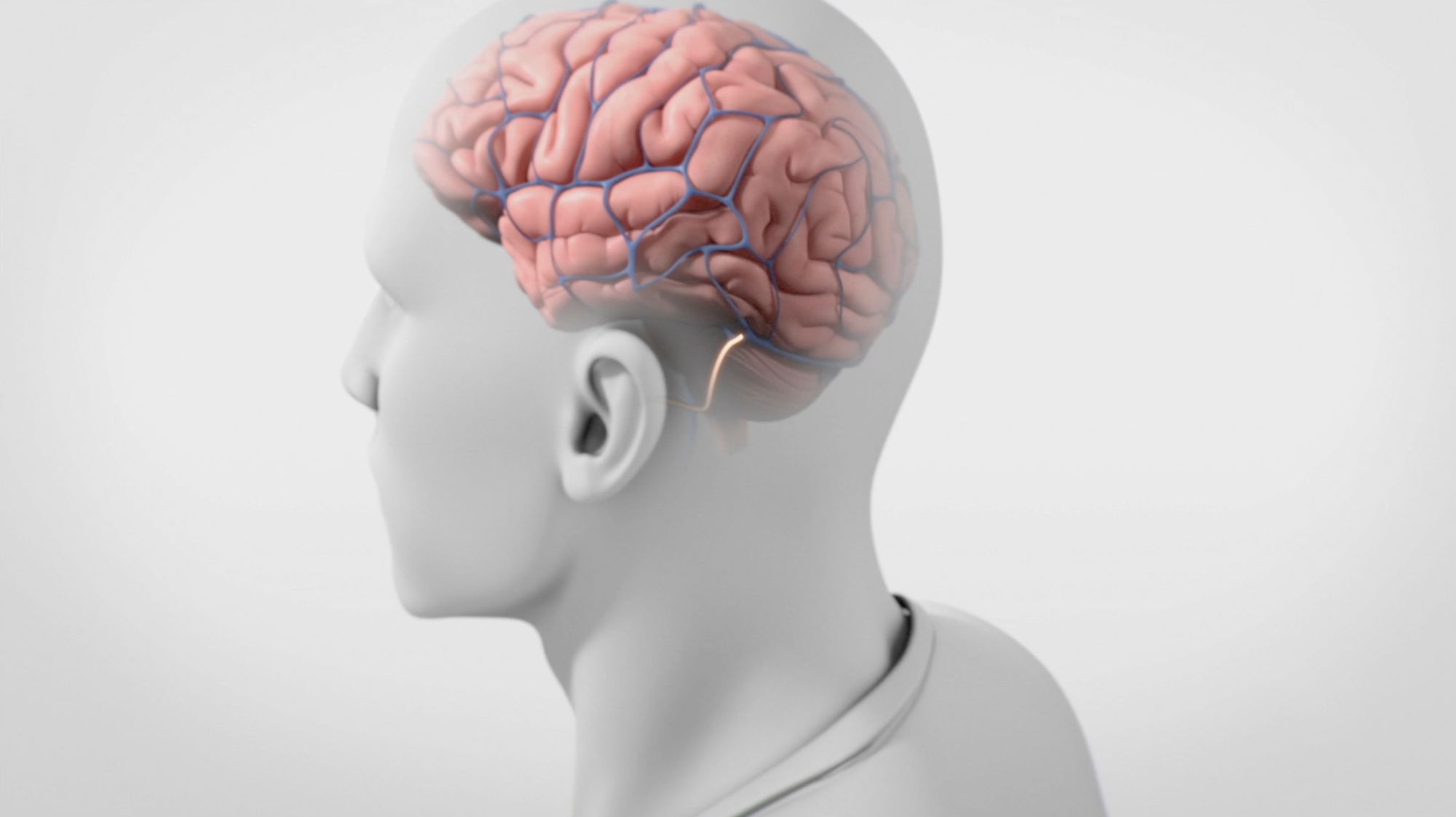 3D Medical Animation Videos | Ghost Productions Inc.