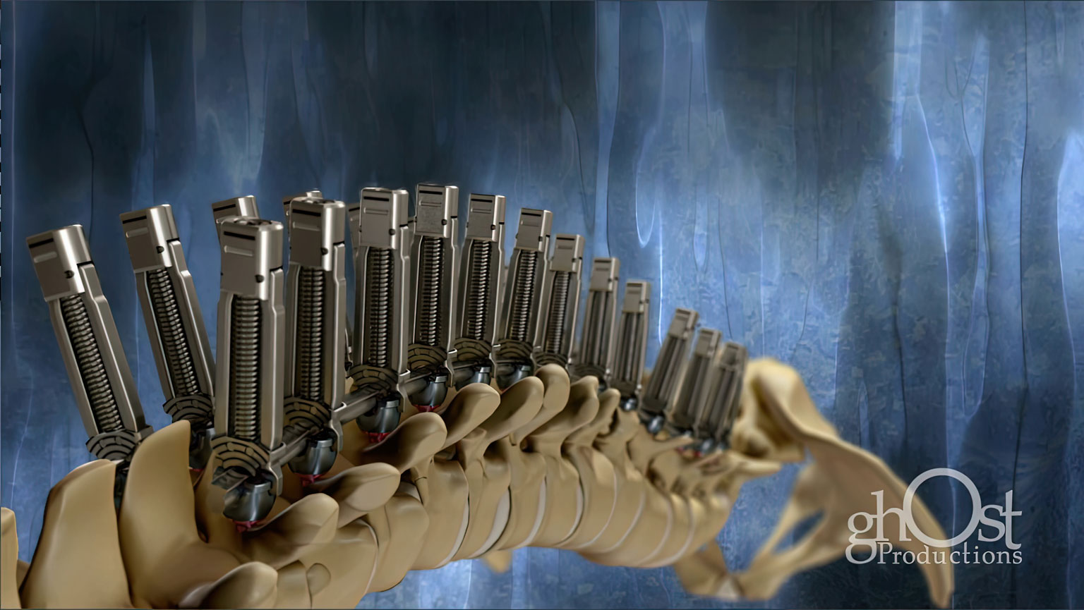 Surgical Technique for Double Major Spinal Deformities | Image