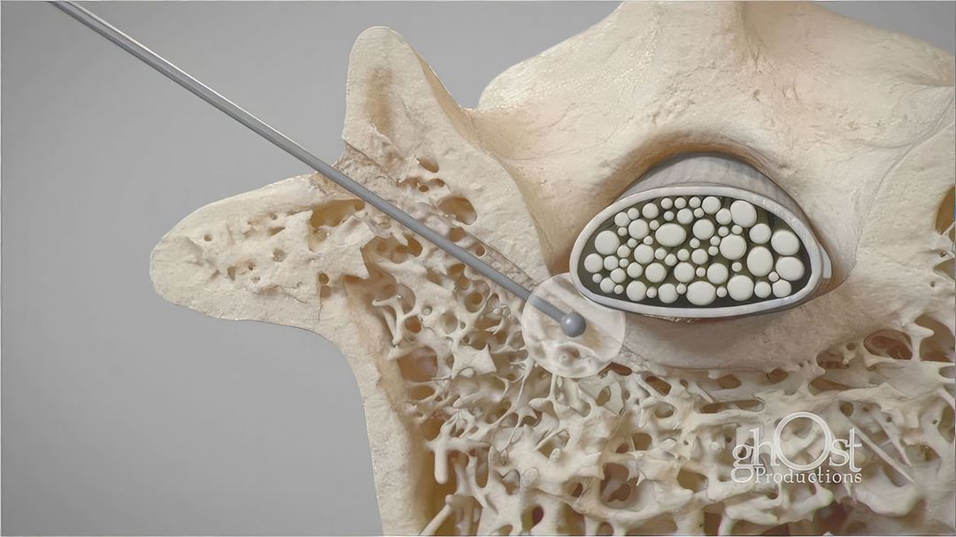 Depuy Synthes Sentio Nerve Mapping System | Image