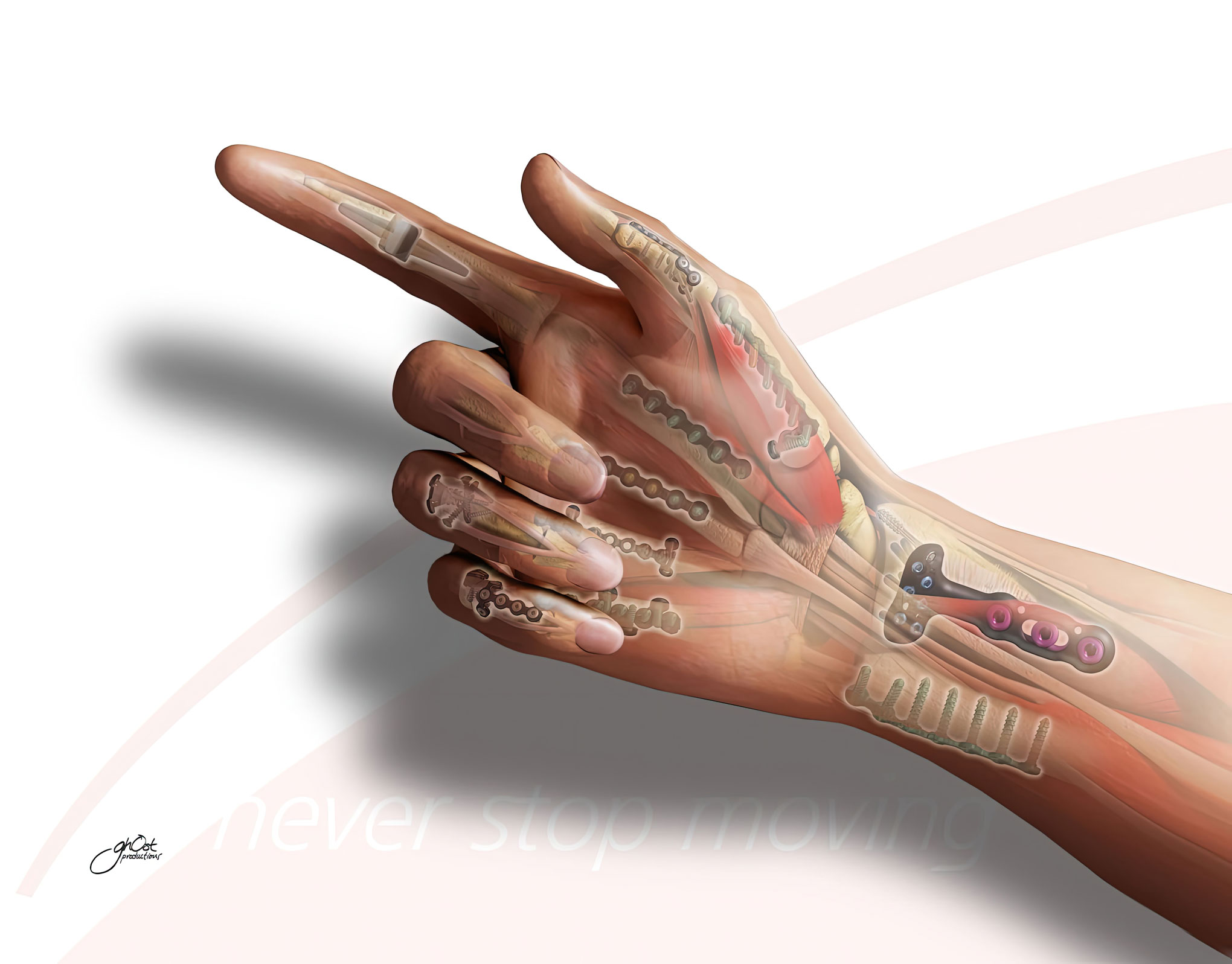 DePuy Hand Trauma Medical Illustration | Image