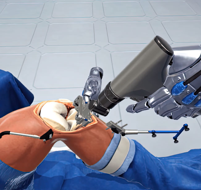 surgical VR total knee surgery training | Image