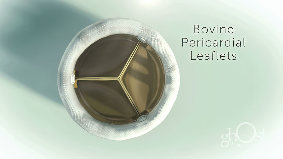 Bovine Pericardial Leaflets | Image