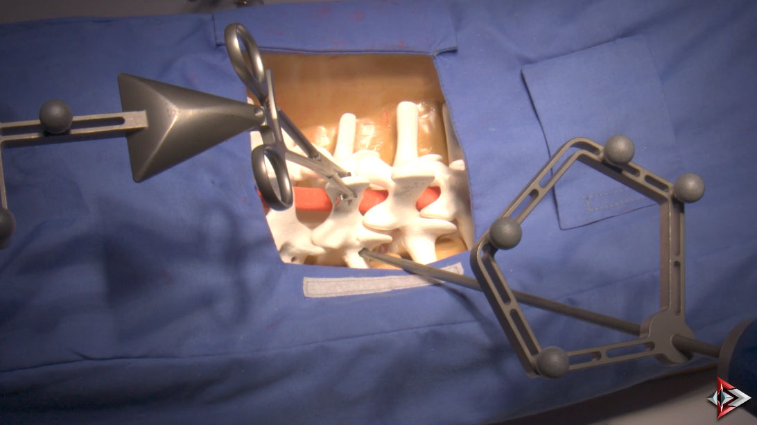 "SeaSpine's Interview of the 7D Flash System at NASS 2023