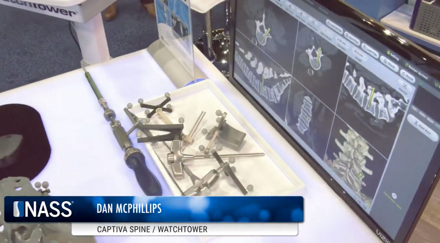 Captiva Spine WatchTower™ Spine Navigation at NASS 2023 | Video