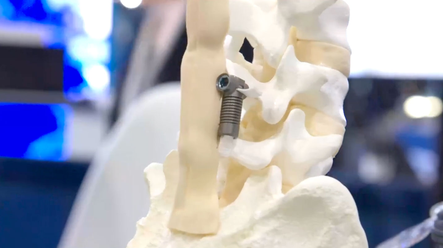 LimiFlex Dynamic Sagittal Tether at NASS 2023 | Video