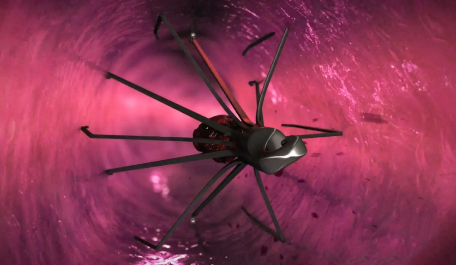 Cardiology Medical Animation | Ghost Medical