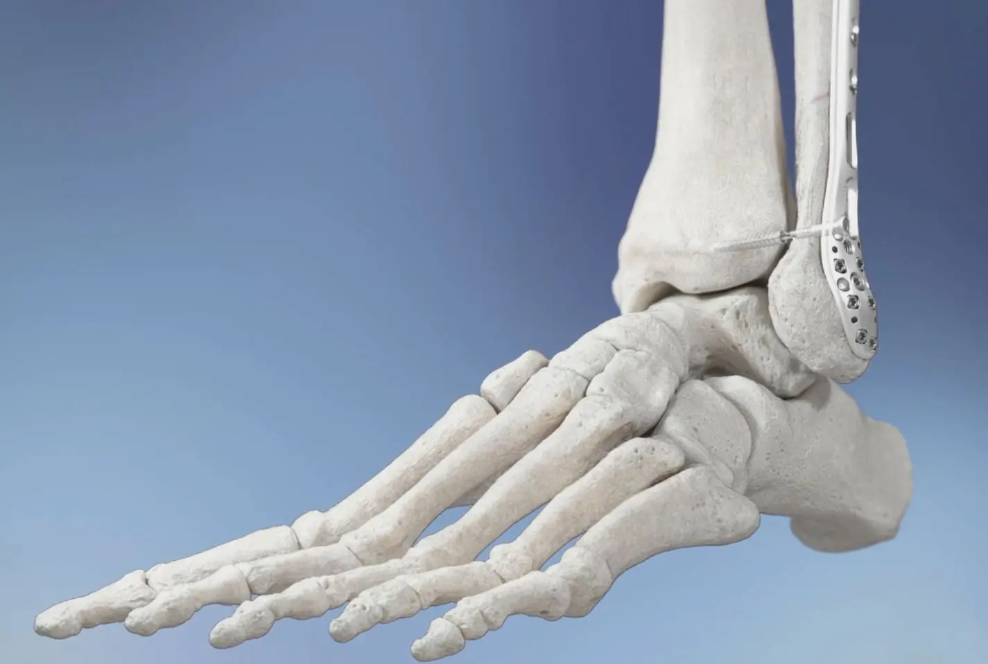 Orthopedic, Sports Medicine, Joint & Trauma animation | Ghost Medical