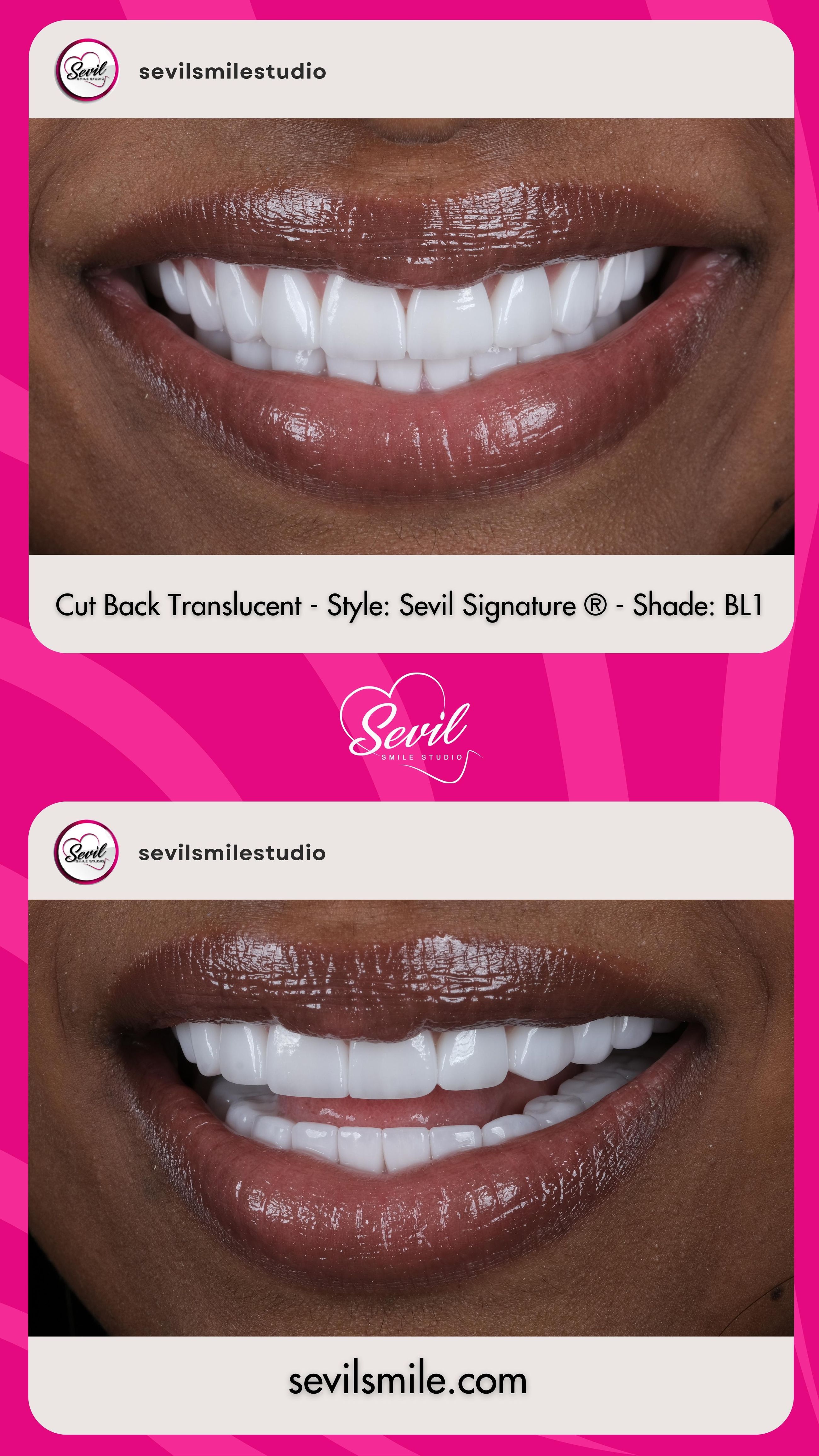 Sevil Smile Studio Official Website | Dentist in Turkey | Dentist in ...