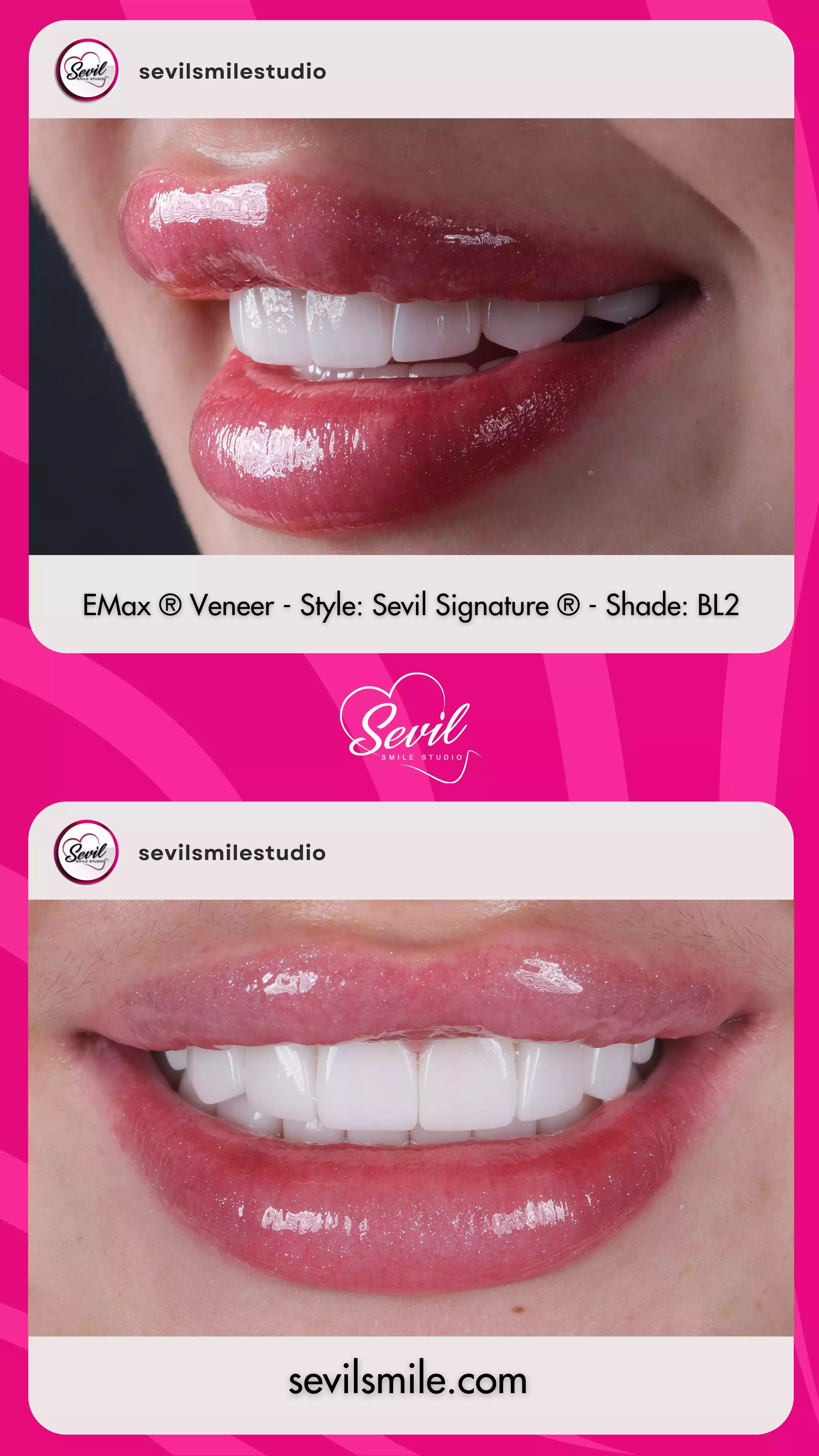 Sevil Smile Studio Official Website | Dentist in Turkey | Dentist in ...