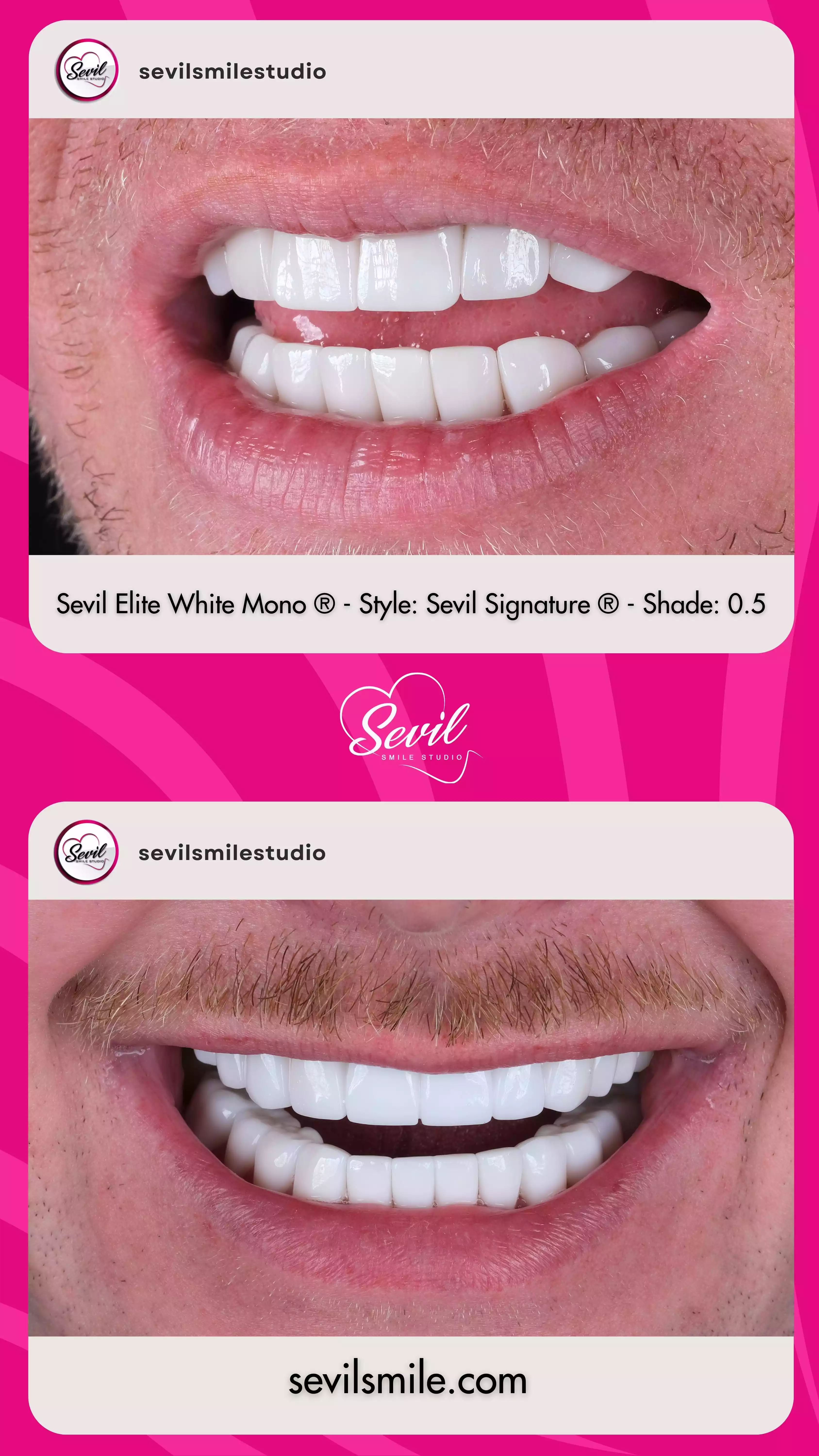 Sevil Smile Studio Official Website | Dentist in Turkey | Dentist in ...