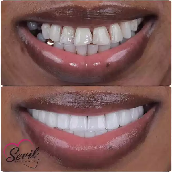 Gallery: Before & After