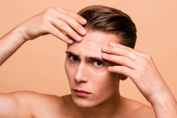 Beauty Med | 6 Most Common Causes of Wrinkled Skin