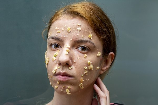 Beauty Med | How To Reduce Redness on the Face Quickly at Home