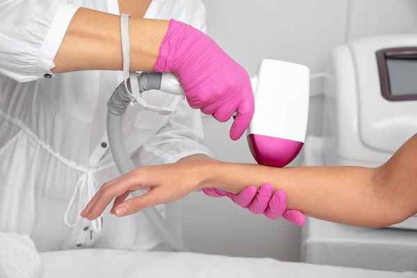 Beauty Med | 7 Best Treatments to Remove Age Spots on Hands