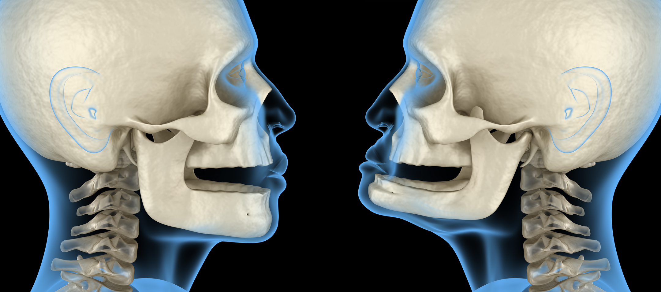 Cosmetic Dentures - Springfield Smile Doctor - Dr. Randi Green