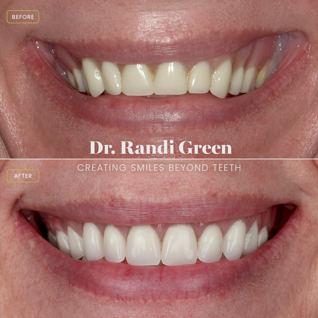 Cosmetic Dentures - Springfield Smile Doctor - Dr. Randi Green
