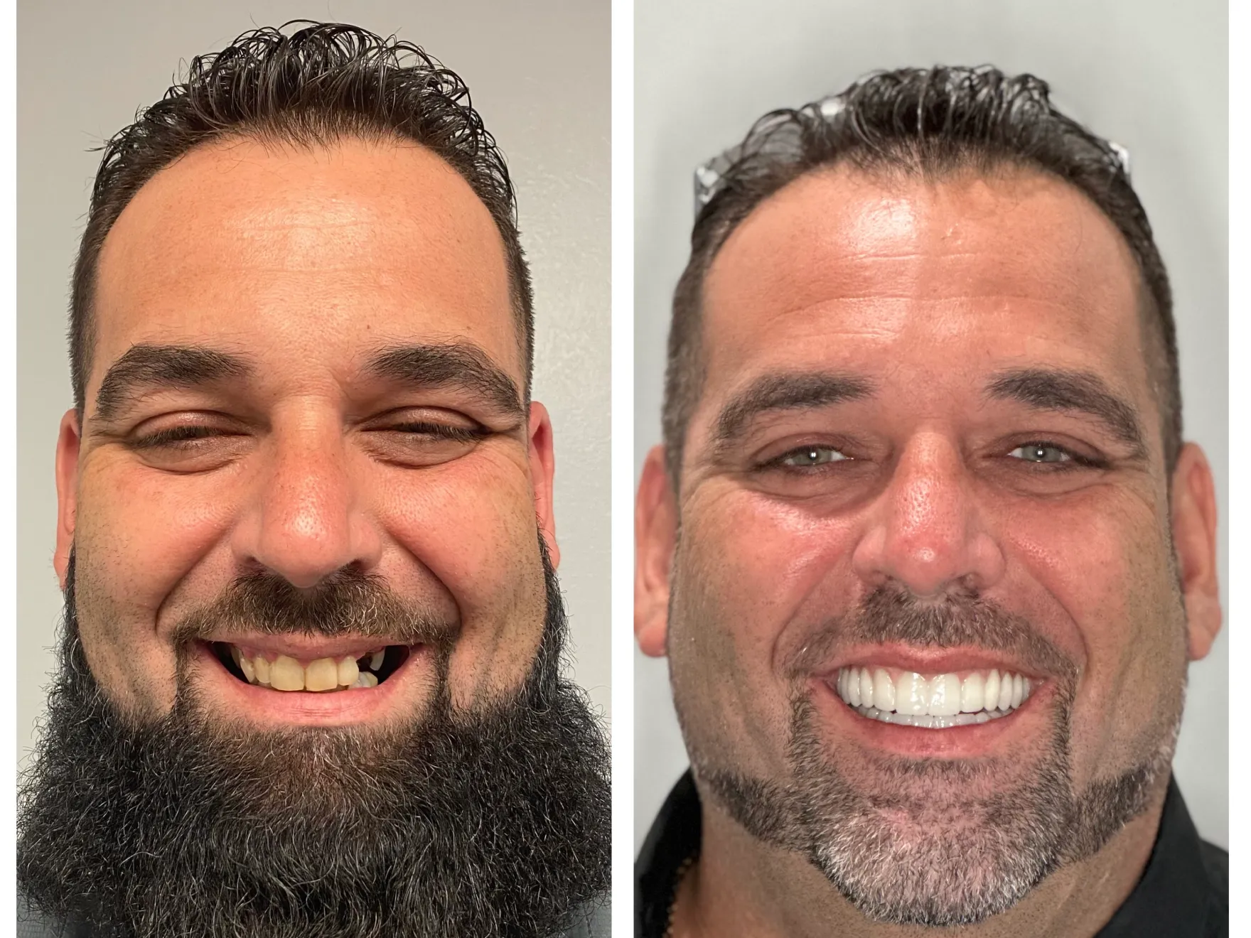 Dentist in Tampa, FL | Optum Dental Arts