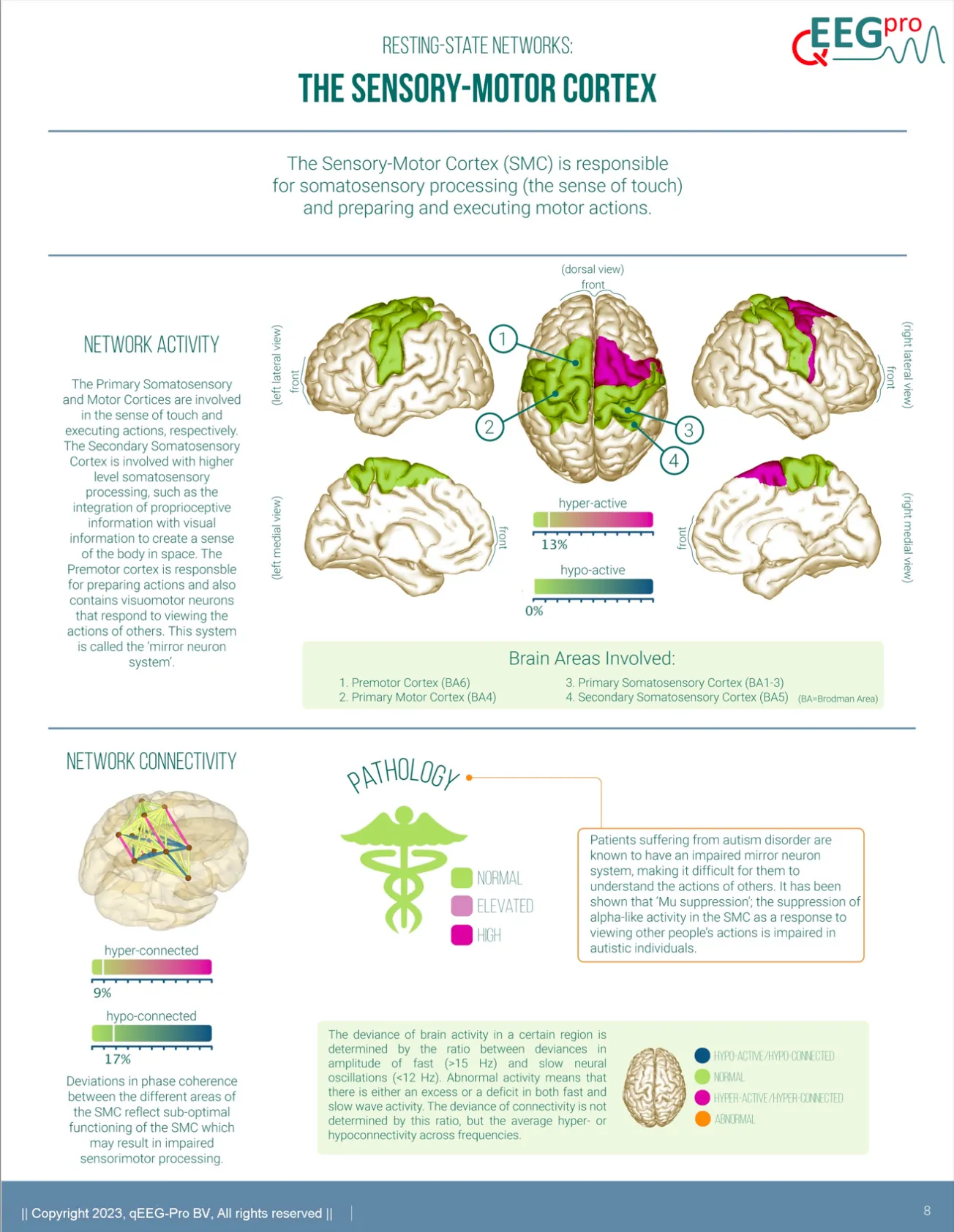 Rewiring the Brain to Fight Dystonia | NeuroSolution Center of Austin