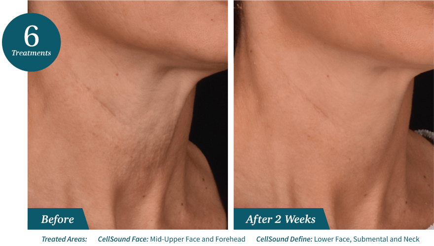 Nuvell Clinics | CellSound Aesthetics®