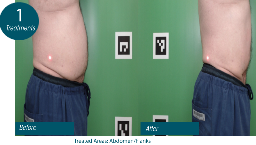 CellSound Aesthetics® | Anti-Aging & Contouring