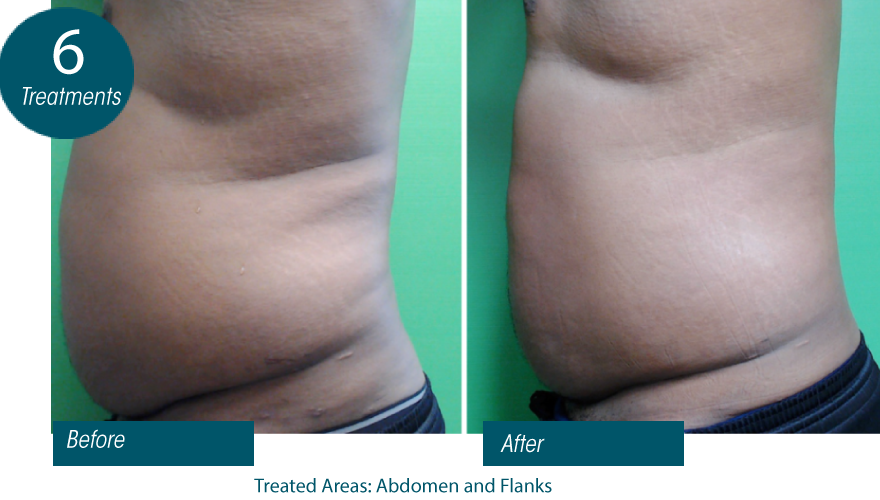CellSound Aesthetics® | Anti-Aging & Contouring