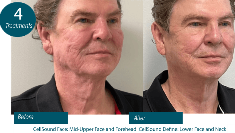 CellSound Aesthetics® | Anti-Aging & Contouring