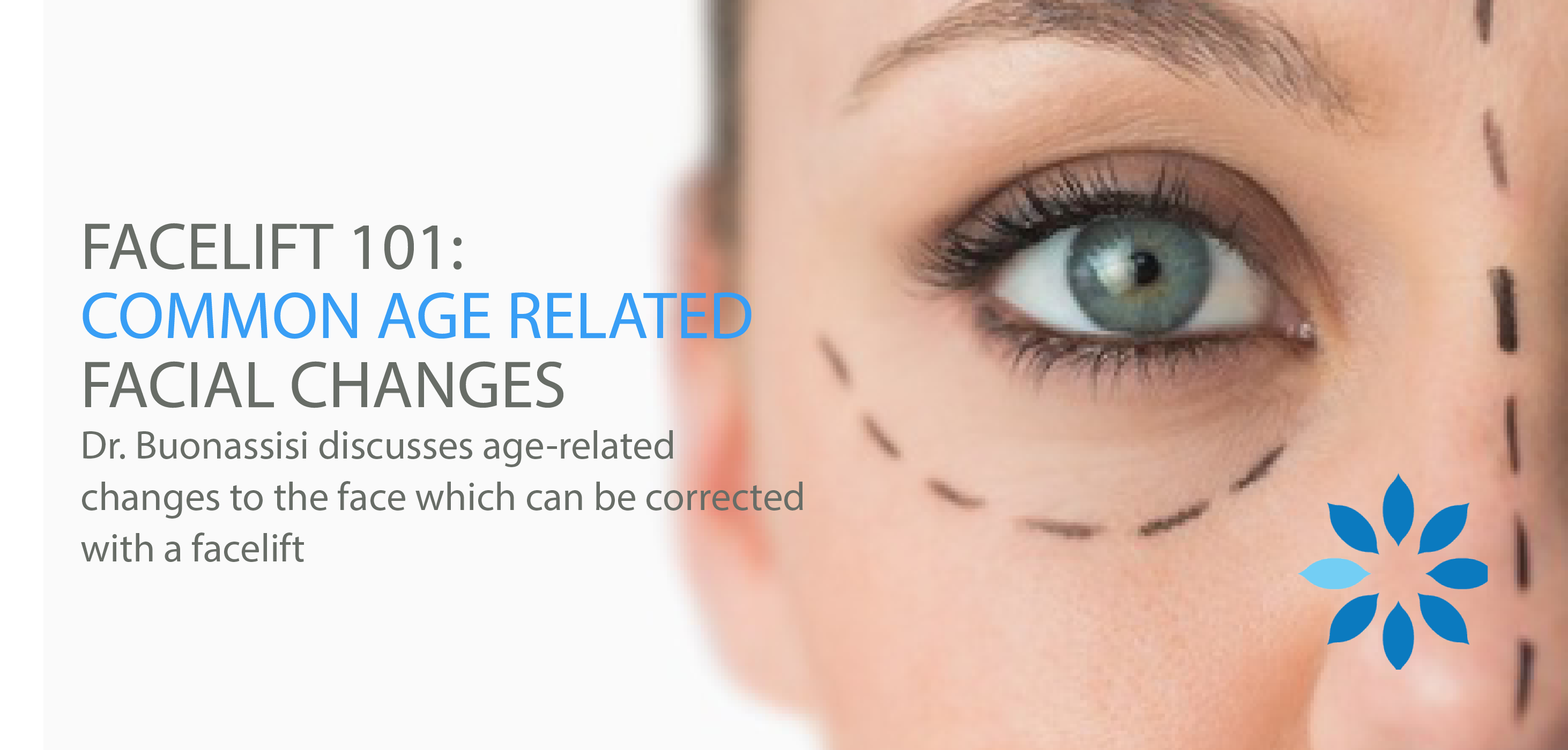 Facelift 101: Common Age-Related Facial Changes | 8 West Vancouver