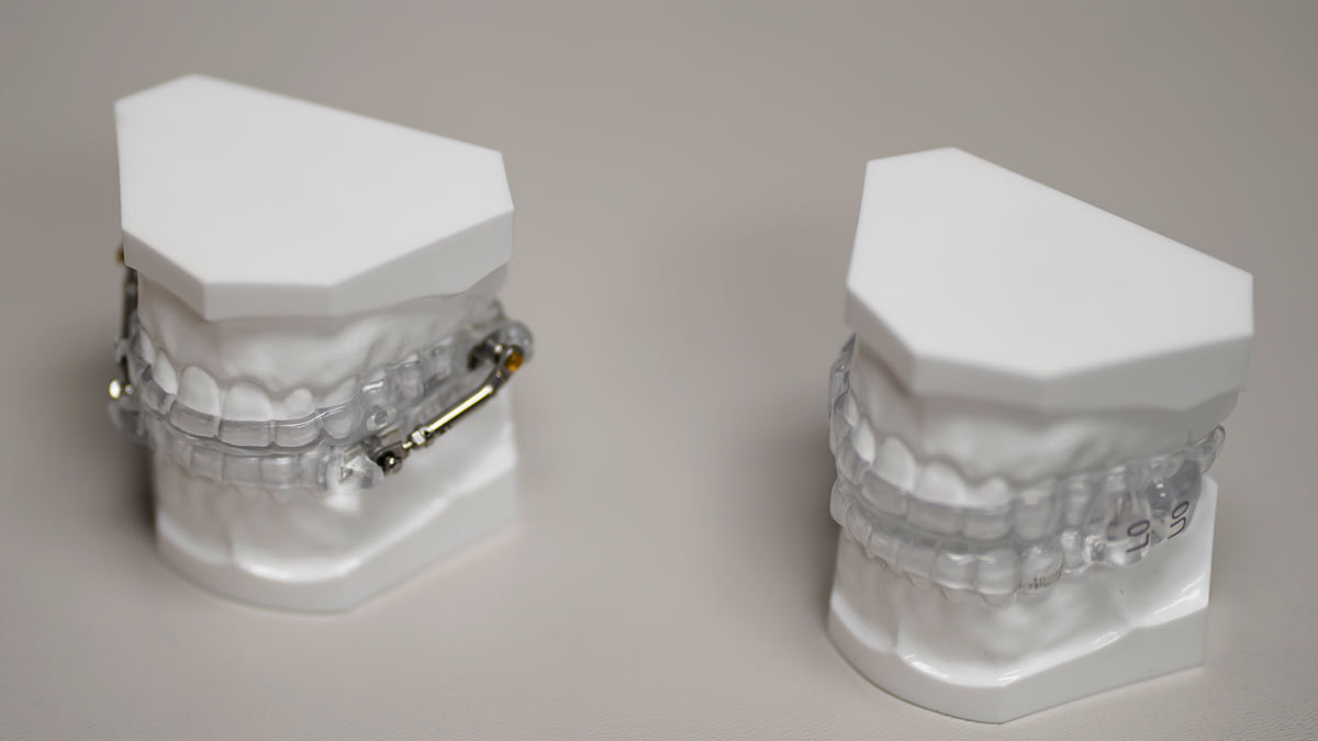 Oral Appliance Therapy: Your CPAP-Free Solution for Better Sleep