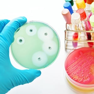 4 Things You Need to Know About Microbial Cell Homogenization