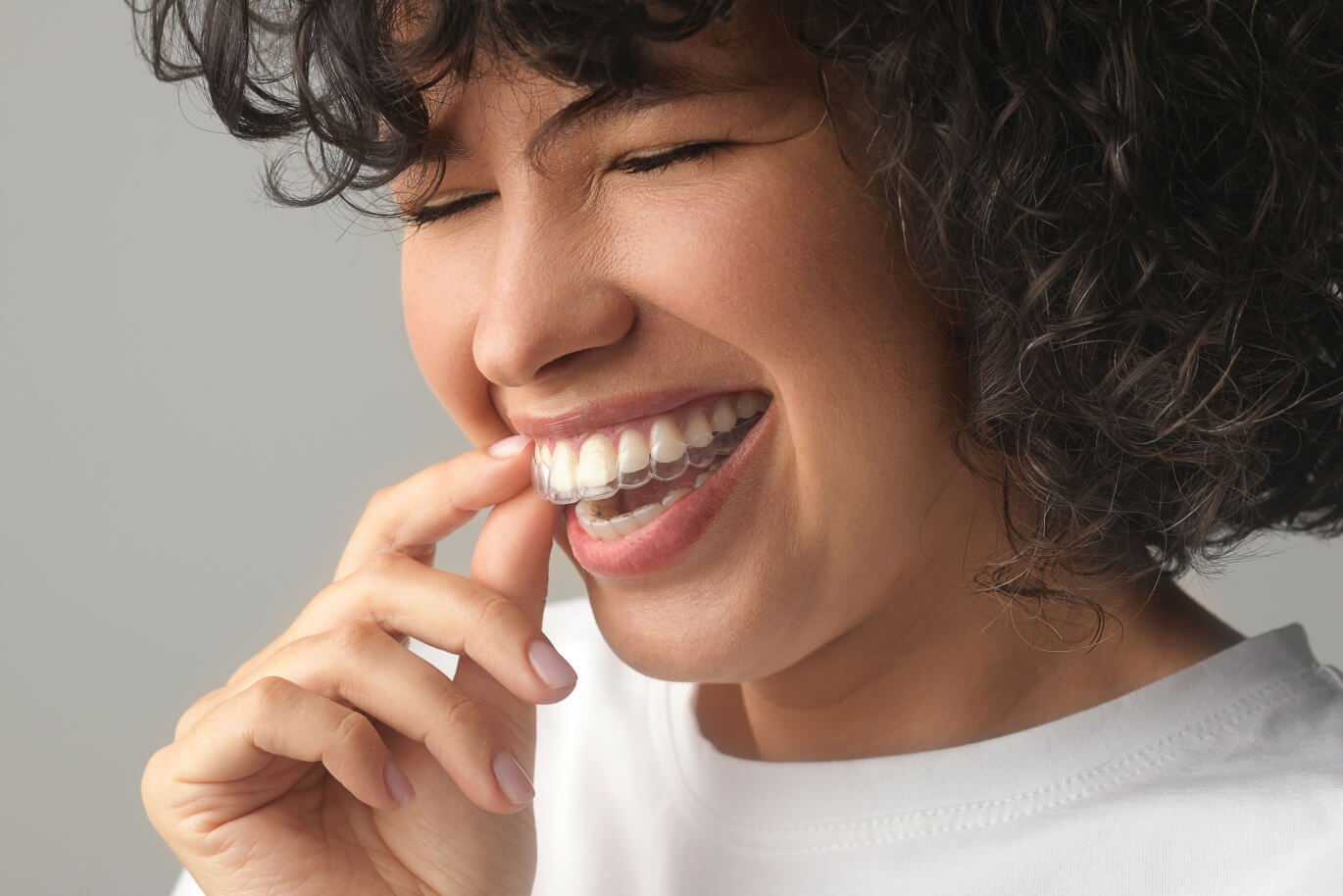 Dantų tiesinimas skaidriomis kapomis „ORDOLINE“ | KOA Klinika