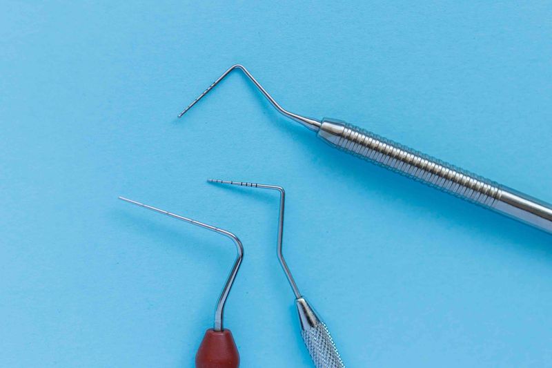 Periodontal Probe | Impact and Significance