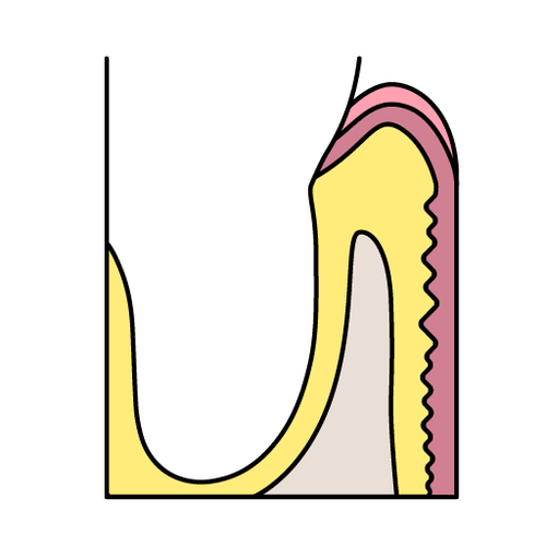 Tooth Periodontal Ligament | Structure, Function, and Health